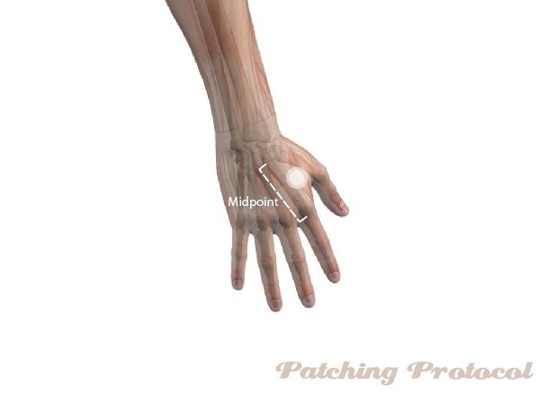 STACKING – Patching Protocol