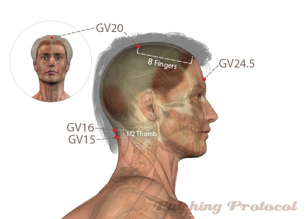 Acupoint location for GV20 – Patching Protocol