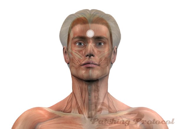 Acupoint location for GV24.5 – Patching Protocol