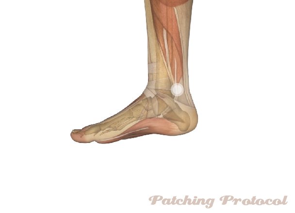 Special Cases – Patching Protocol