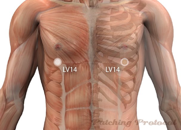 Acupoint location for LV14 – Patching Protocol