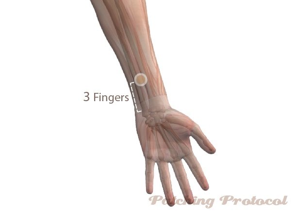 Acupoint location for PC6 L SIDE – Patching Protocol