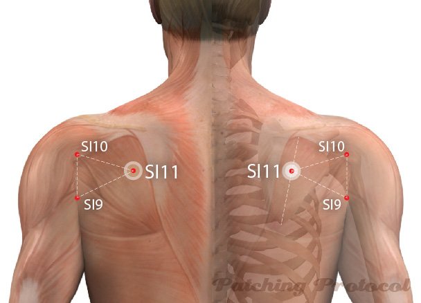 Acupoint location for SI11 – Patching Protocol