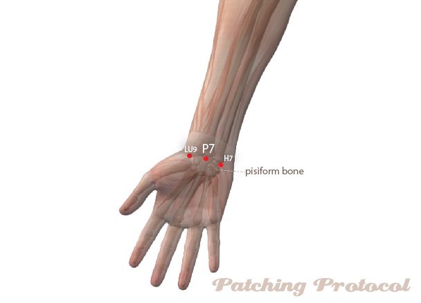 Acupoint location for P7 – Patching Protocol