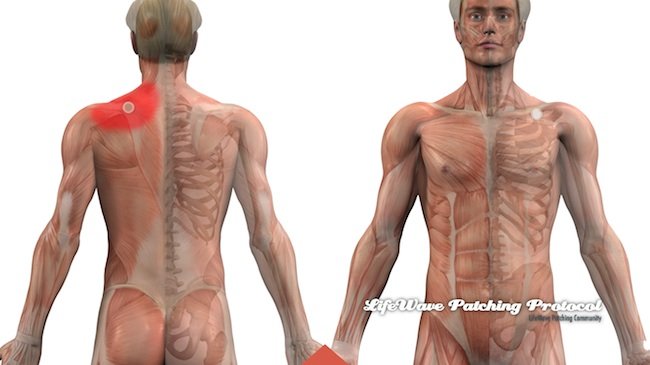 Ice Wave Patches - Patching Protocol