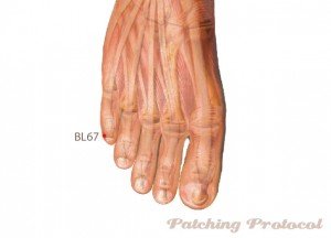 Difficult Birth Labour Story - Patching Protocol