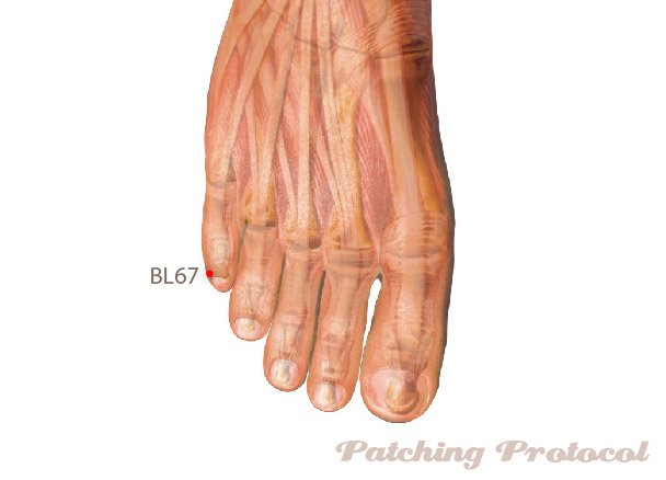 Difficult Birth Labour Story - Patching Protocol