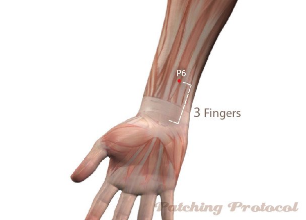 Acupoint location for P6 – Patching Protocol