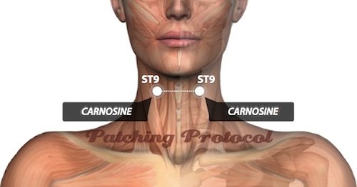 LifeWave Patches and Tonsils Infection - Patching Protocol