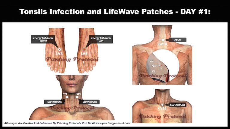 LifeWave Patches and Tonsils Infection - Patching Protocol