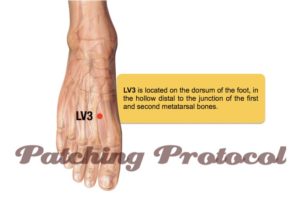 LifeWave Patches And Nausea – Patching Protocol
