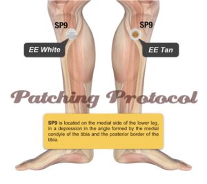 Applying Lifewave Patches For Swelling of the Joints - Patching Protocol