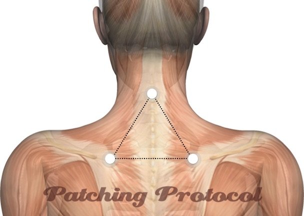 SHAPING – Patching Protocol